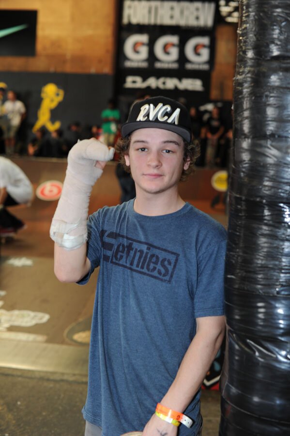 Timmy Johnson broke the same bone in his hand — Skatepark of Tampa